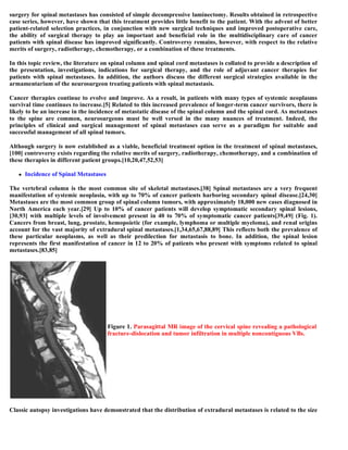 Case record...Spinal metastasis | PDF