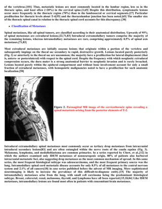 Case record...Spinal metastasis | PDF