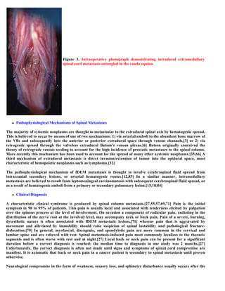 Case record...Spinal metastasis | PDF