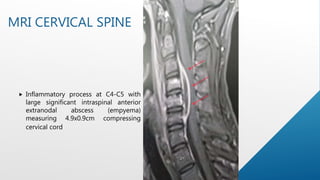 Brucellosis with cervical abscess | PPT