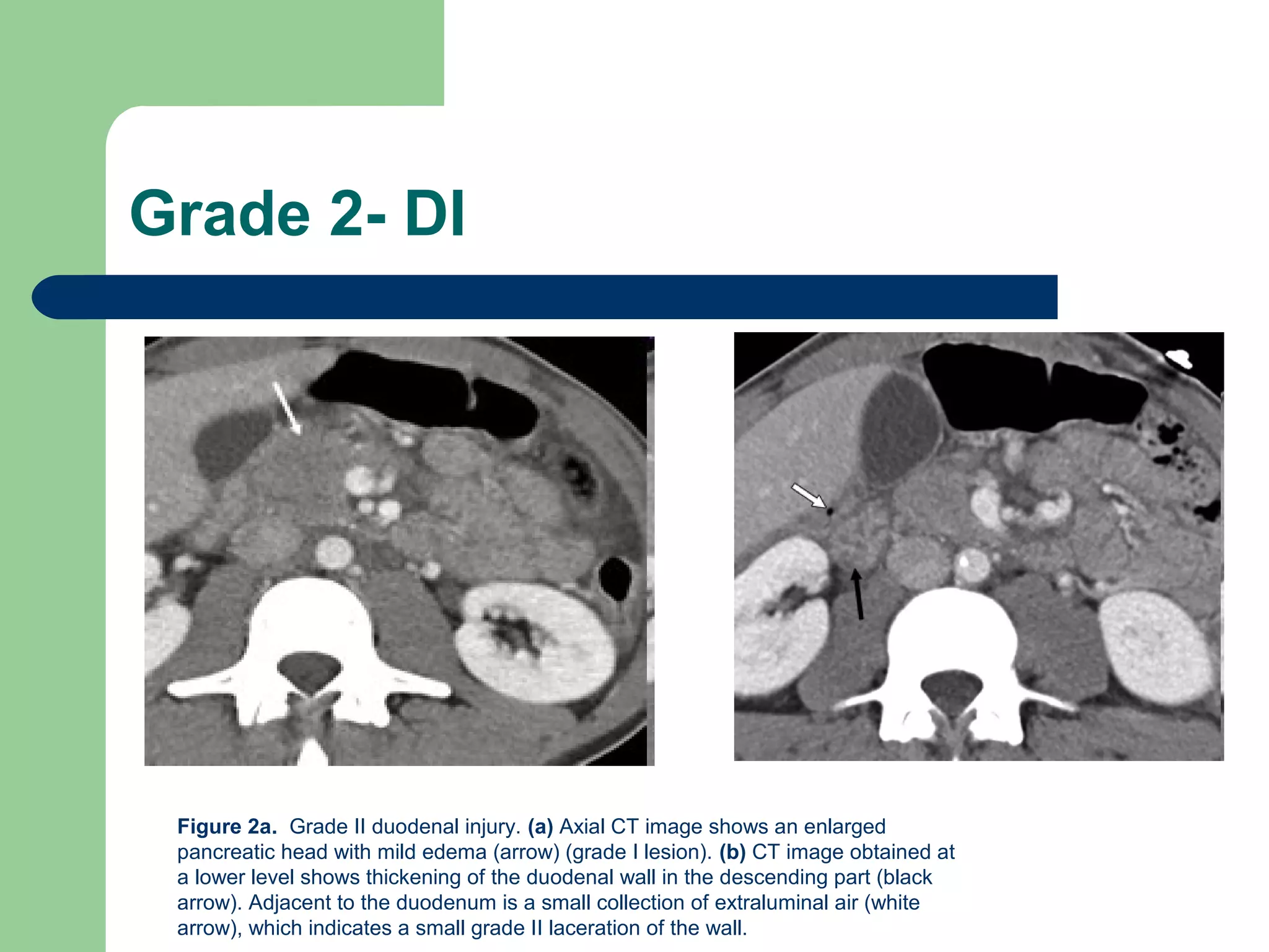 Case study nhung 11.12.12