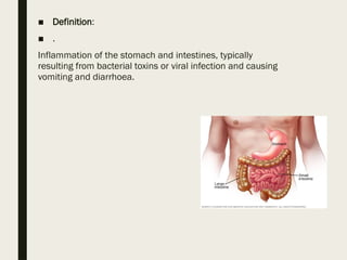 case presentation on acute gastroenteritis.pptx