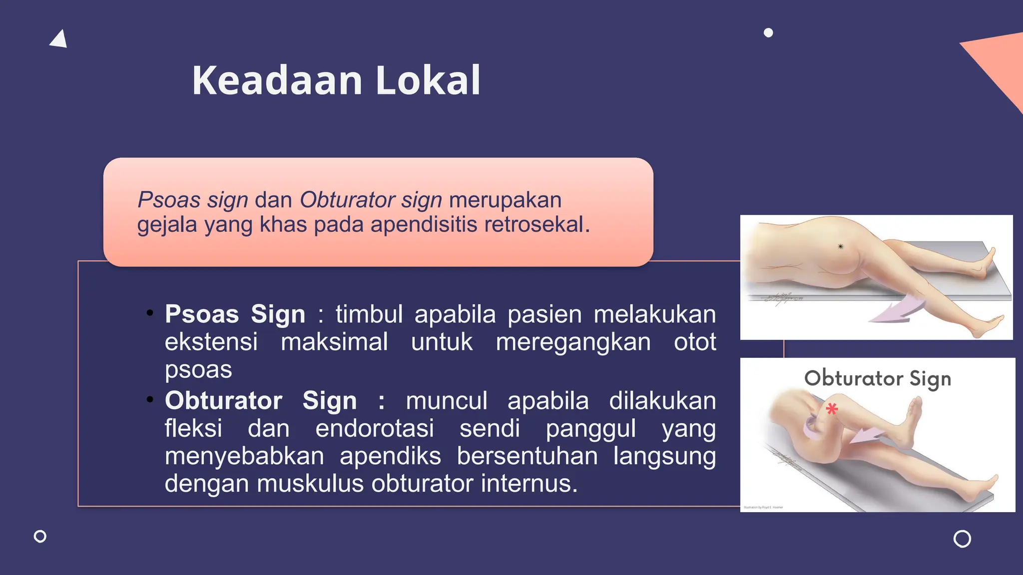 Case Report- Acute Apendicitis by dr.ifan).pptx