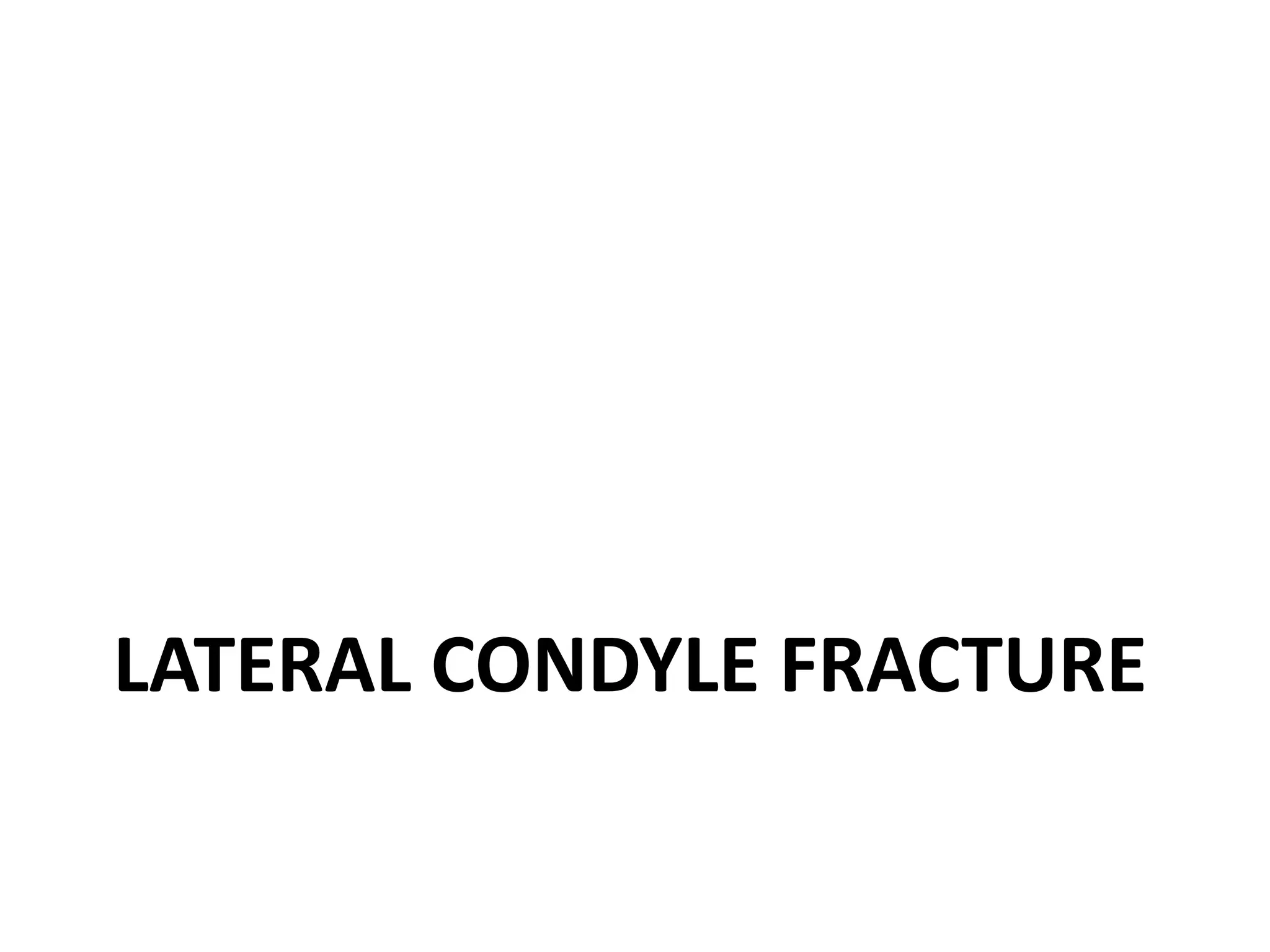 Case discussion lateral condyle fracture | PPTX