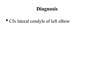 Case discussion lateral condyle fracture | PPTX