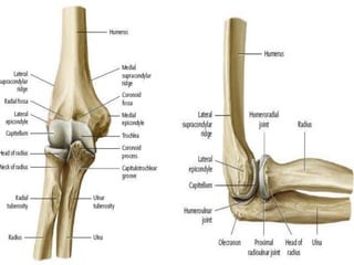 Case discussion lateral condyle fracture | PPTX