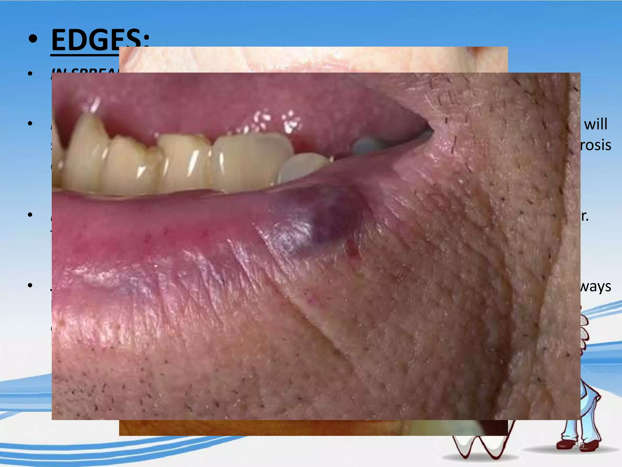 DENTAL CASE HISTORY (DEMOGRAPHIC DATA ,CHIEF COMPLAINT,HOPI) | PPTX