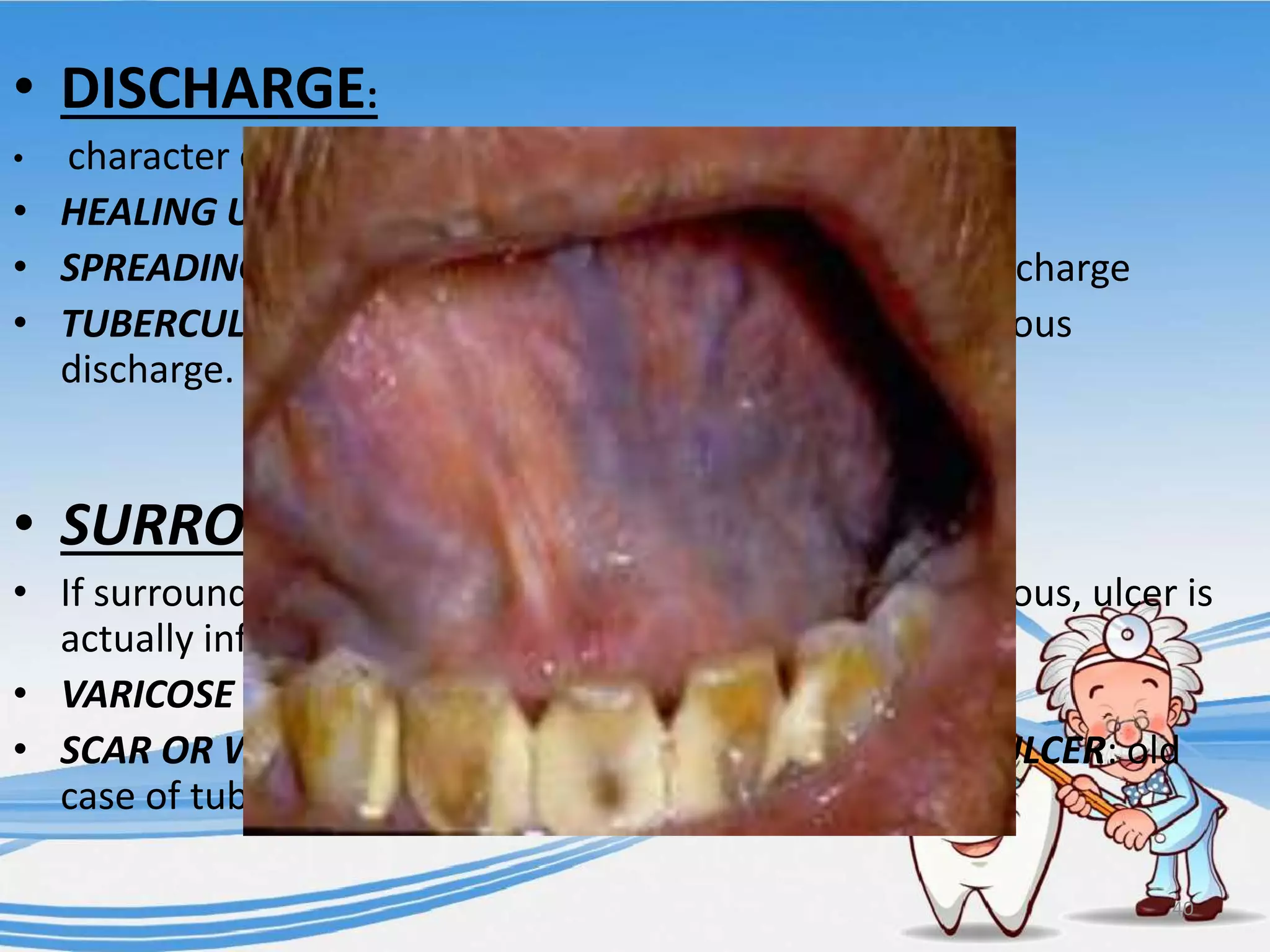 DENTAL CASE HISTORY (DEMOGRAPHIC DATA ,CHIEF COMPLAINT,HOPI) | PPTX
