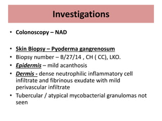 Leg ulcer D/Ds | PPTX