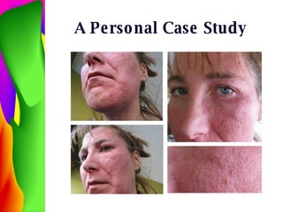 Case Method Teaching | PPT