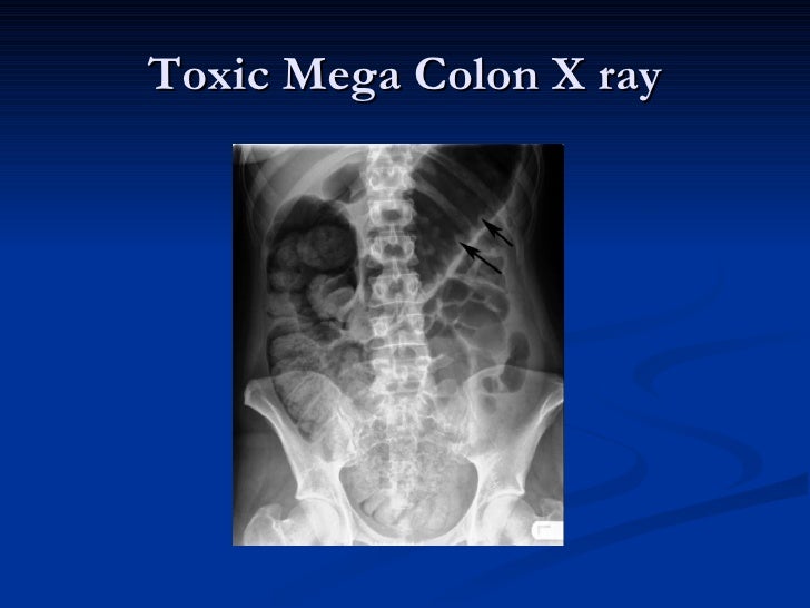 Case Presentation 07