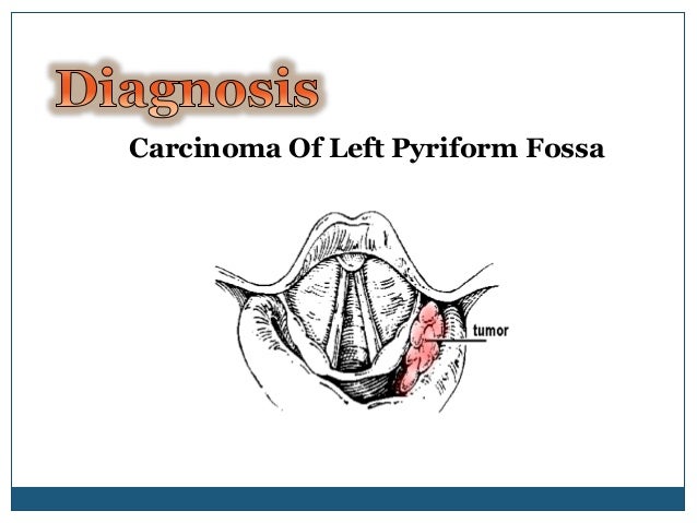 Case presentation on cancer