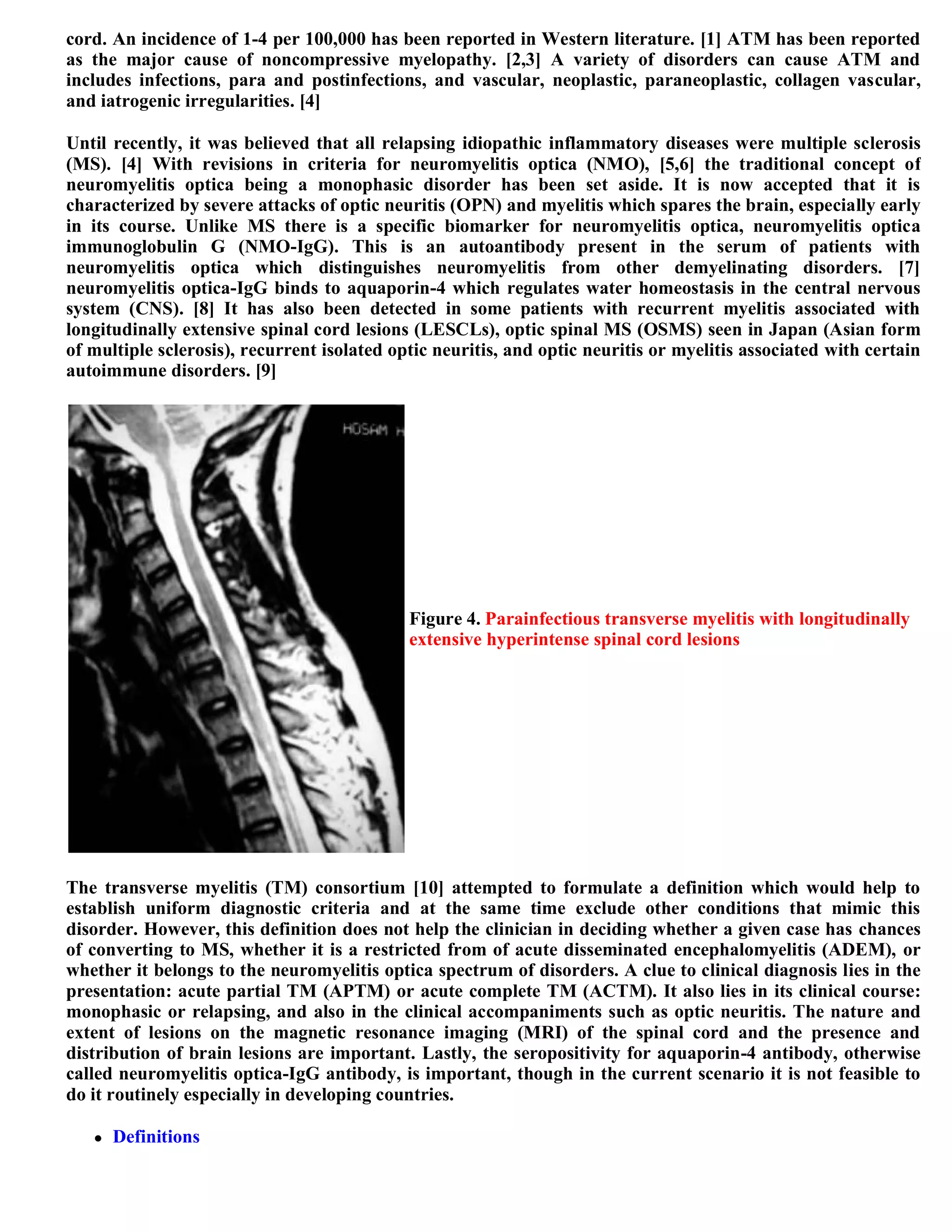 Case record...Acute postinfectious transverse myelitis (Transverse ...