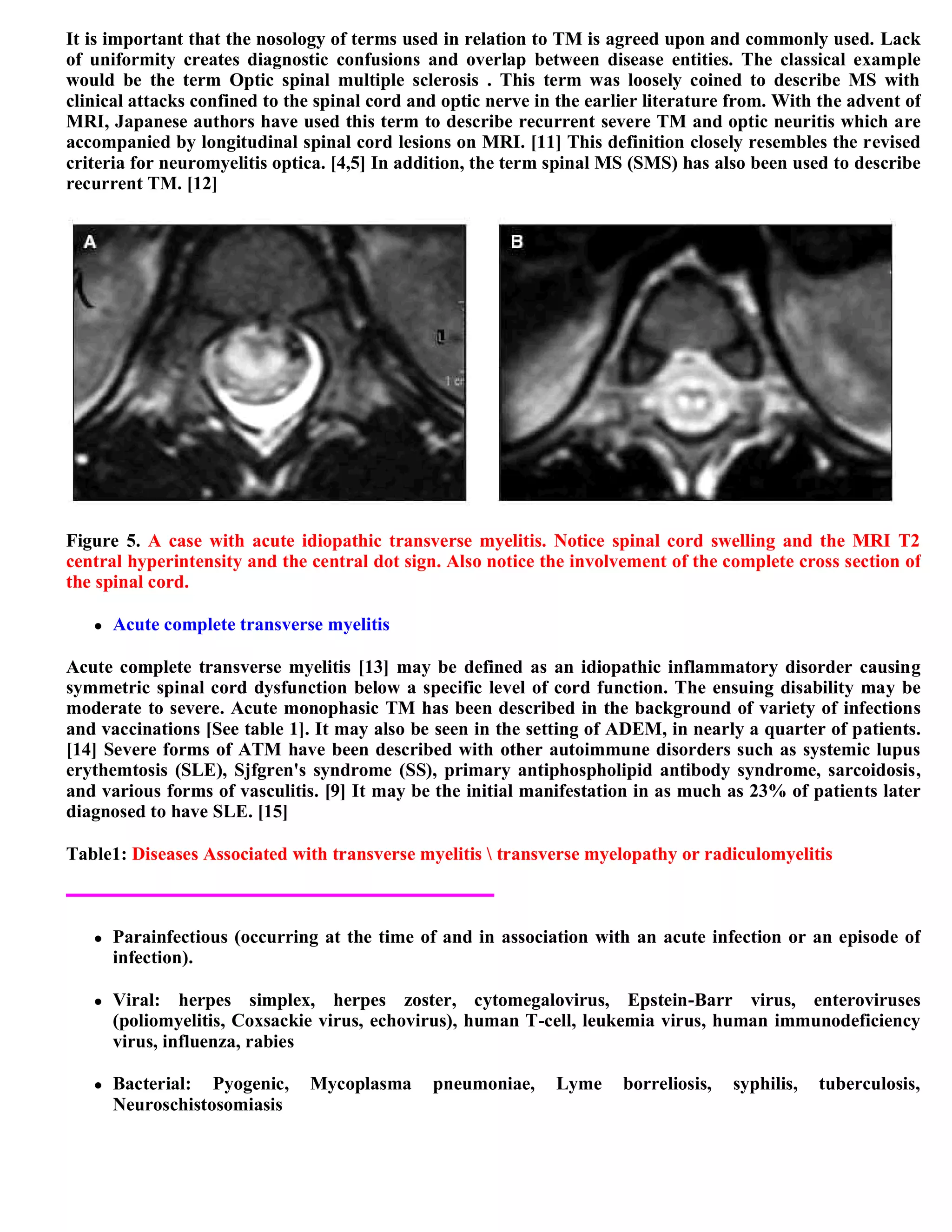 Case record...Acute postinfectious transverse myelitis (Transverse ...