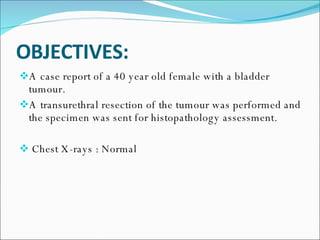 Case Report – Small Cell Carcinoma Bladder | PPT
