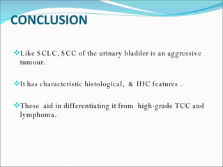 Case Report – Small Cell Carcinoma Bladder | PPT