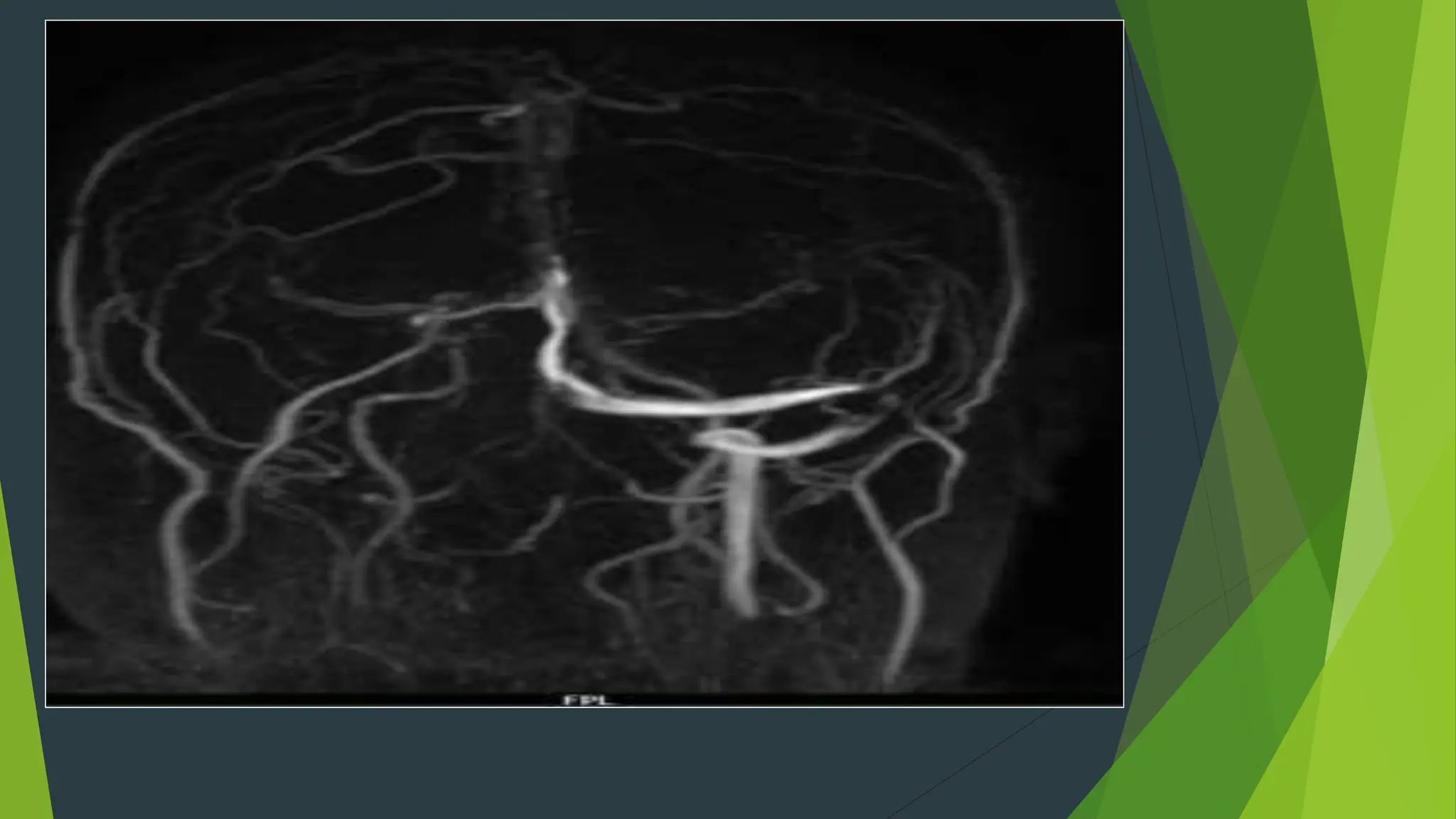 CASE-REVERSE detailed formats in_INO.pptx
