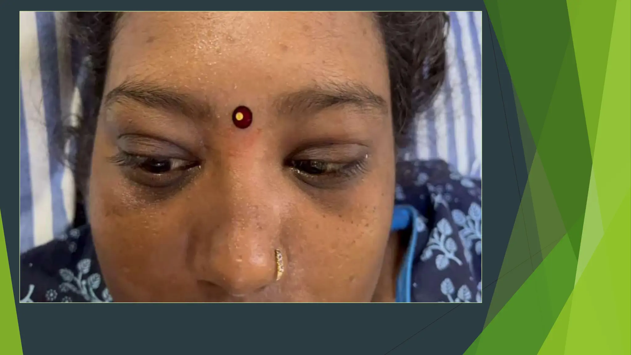 CASE-REVERSE detailed formats in_INO.pptx