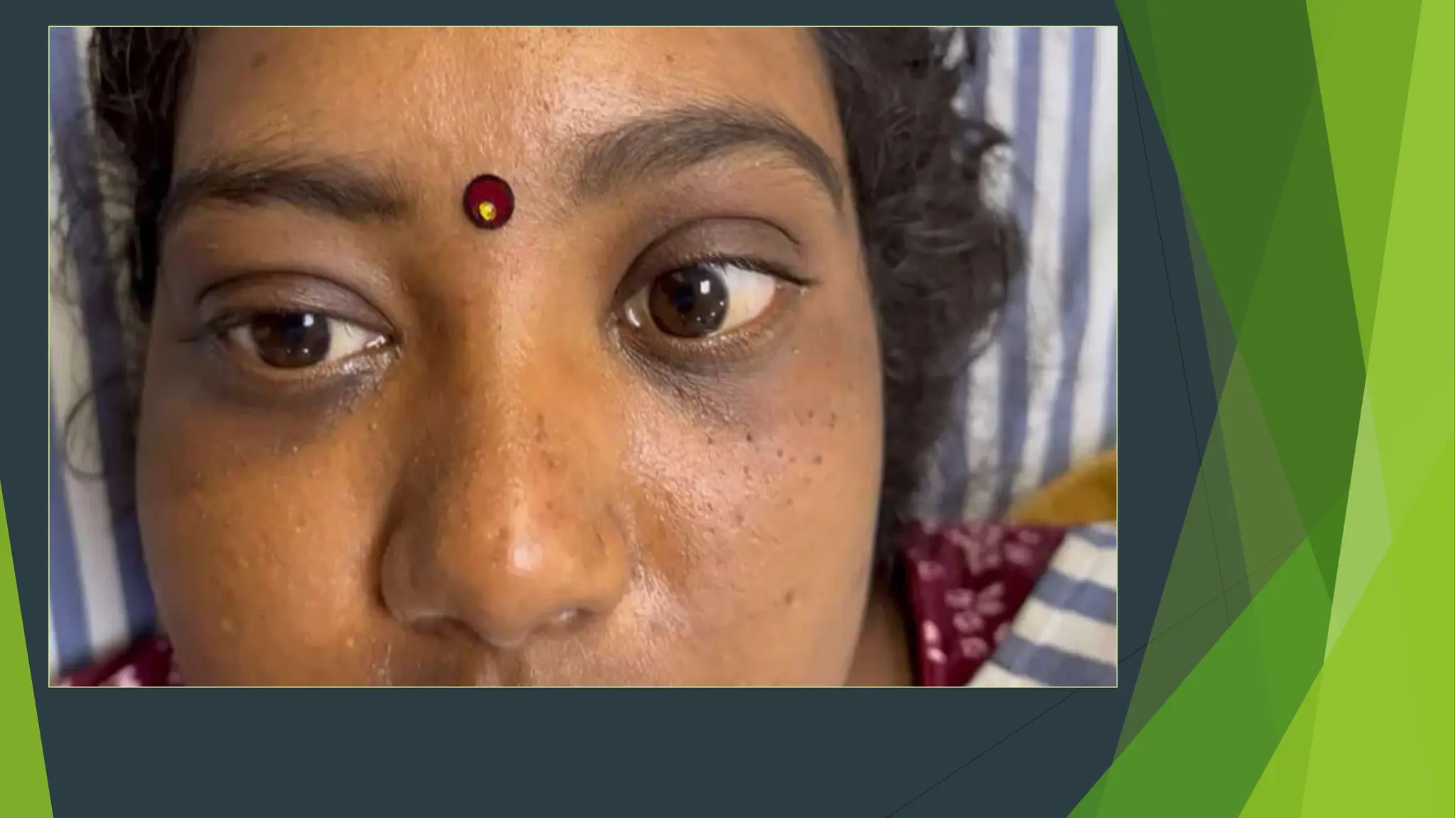 CASE-REVERSE detailed formats in_INO.pptx