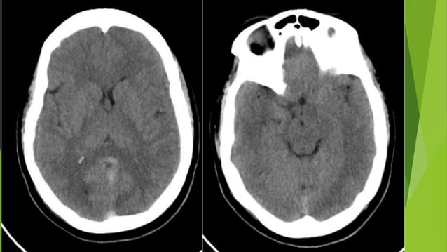 CASE-REVERSE detailed formats in_INO.pptx