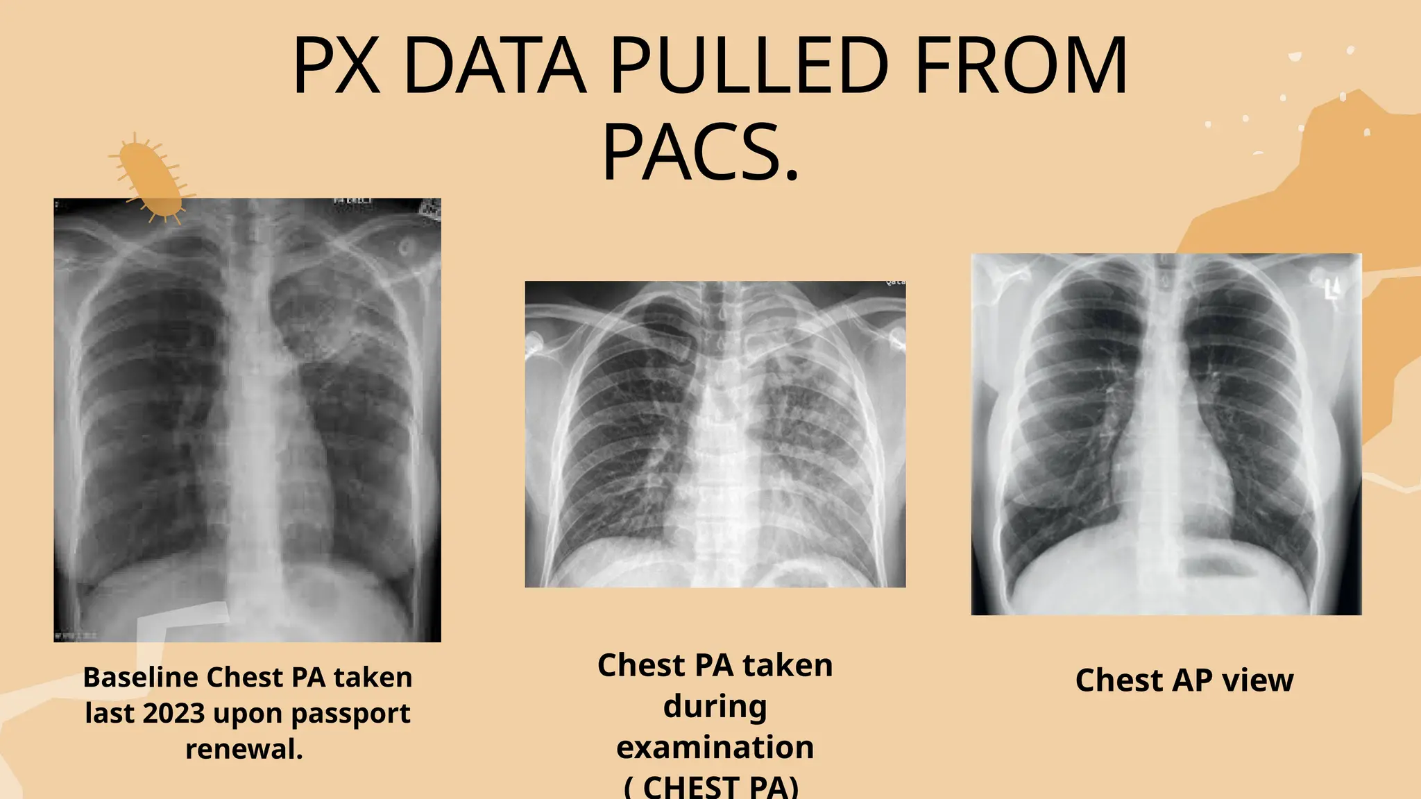 respiratory system, case study.presentation.pdf. | PPTX
