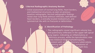 respiratory system, case study.presentation.pdf. | PPTX
