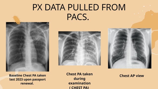 respiratory system, case study.presentation.pdf. | PPTX | Lung and ...