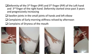 Rheumatoid Arthritis case presentation - treatment choice | PPTX | Bone ...