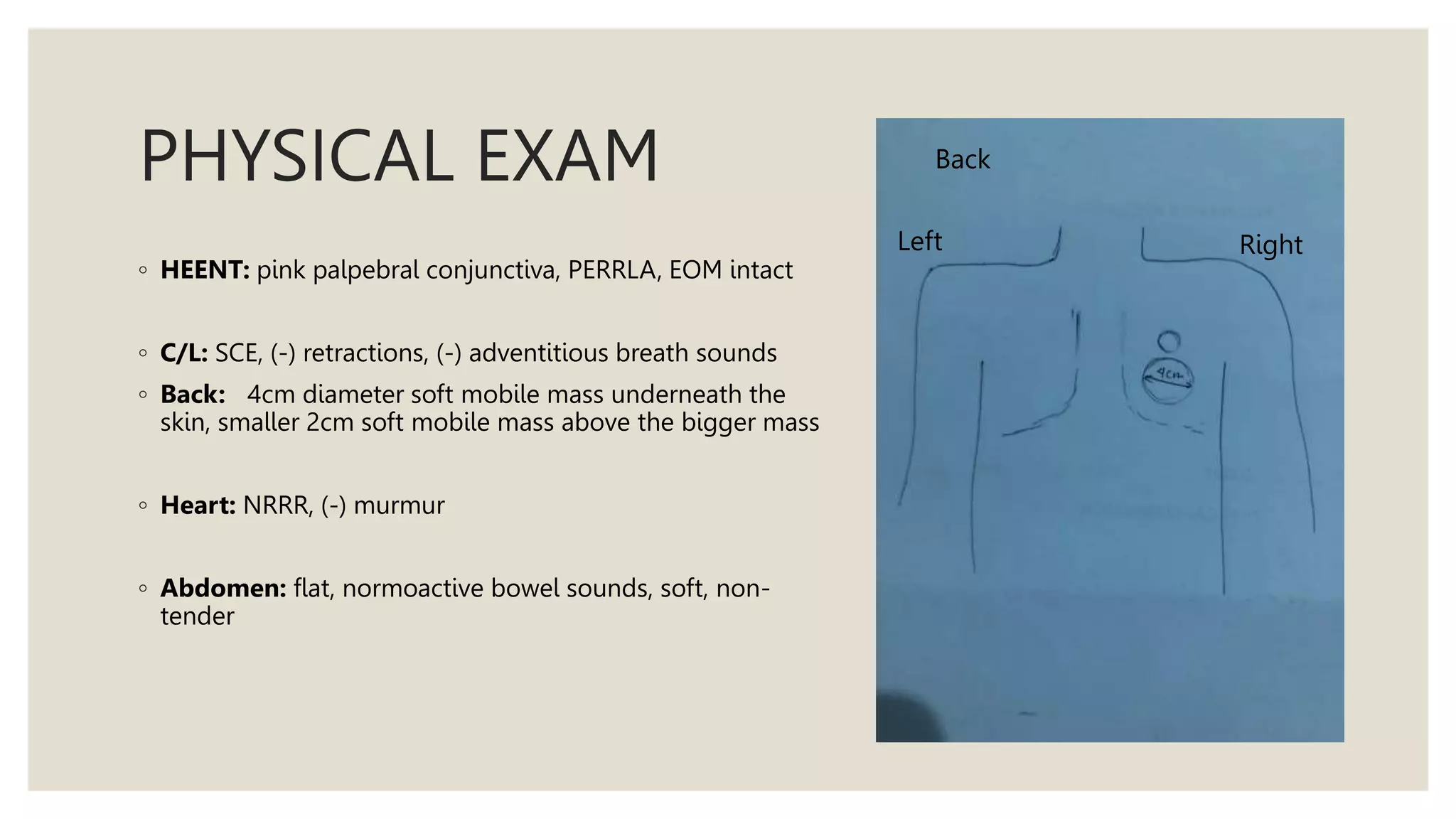 CASE 1-Surgery Excision Lipoma.pptx