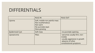 CASE 1-Surgery Excision Lipoma.pptx