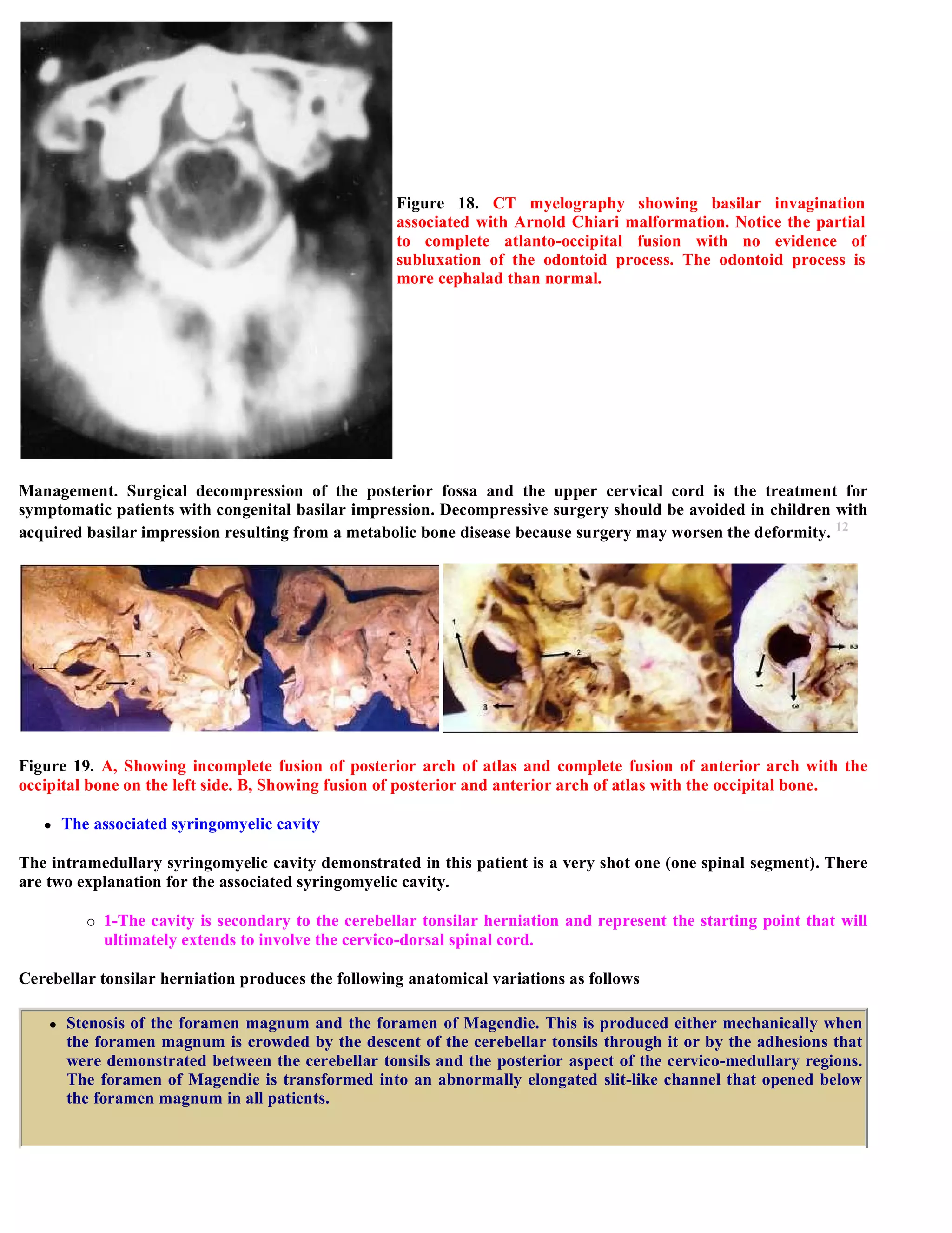 Case record...Congenital craniocervical anomalies | PDF
