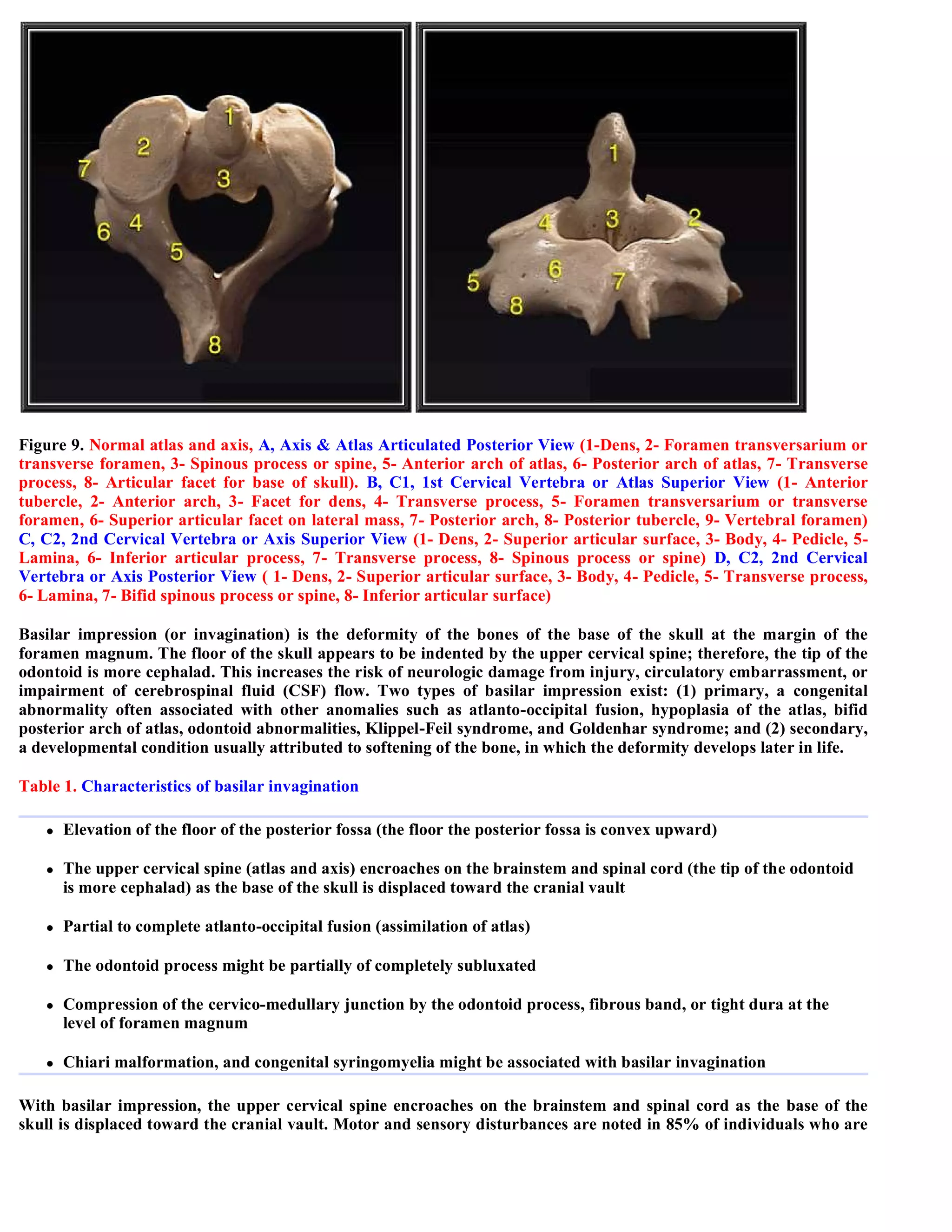 Case record...Congenital craniocervical anomalies | PDF