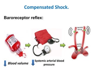 trauma and bleeding (hemorrhagic shock) | PPTX