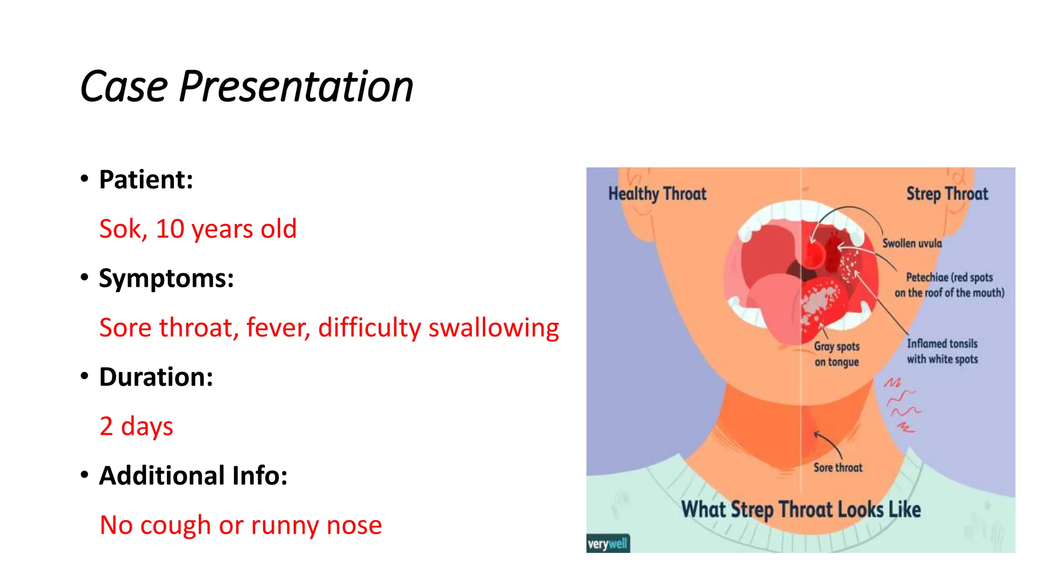 Stretococcal Pharyngitis ( Strep Throat ) | PPT