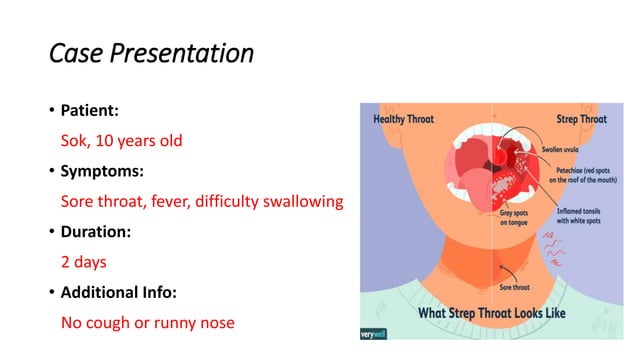 Stretococcal Pharyngitis ( Strep Throat ) | PPT