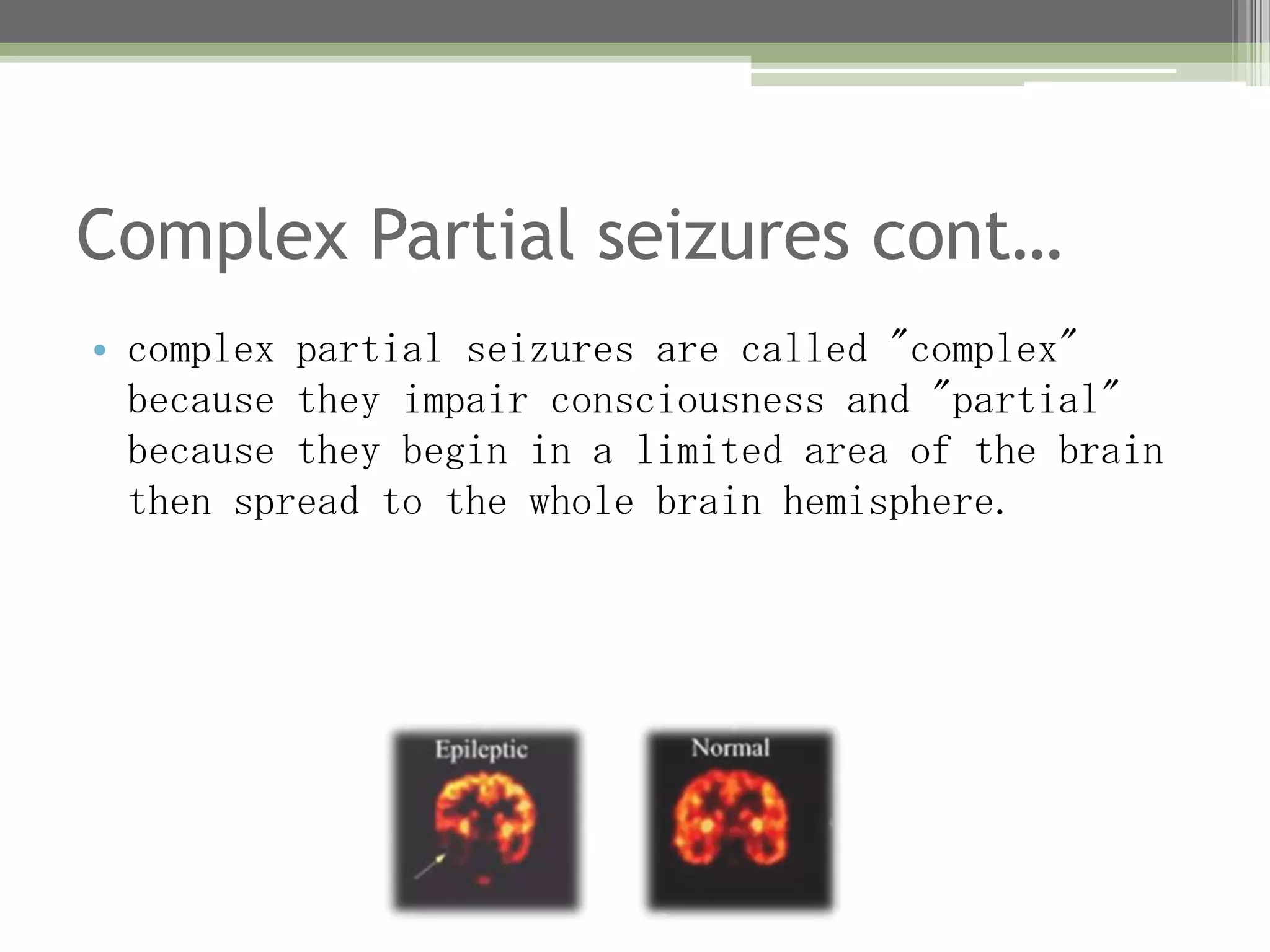 Complex partial seizures | PPTX