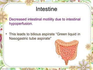 Hypovolemic Shock | PPT