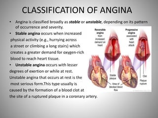 Case presentation on angina pectoris | PPTX