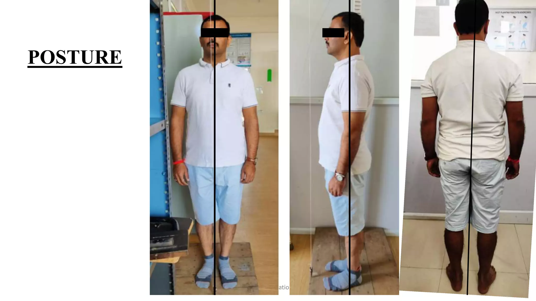 Physiotherapy Case presentation | PPTX