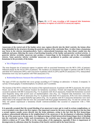Case record...Ruptured anterior communicating aneurysm | PDF