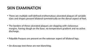 IgA vasculitis (A Case Presentation).pptx