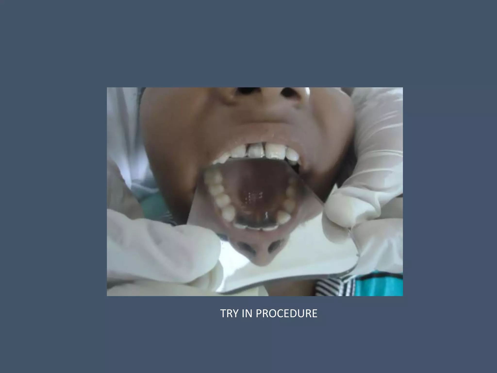 Maryland Bridge | PPTX