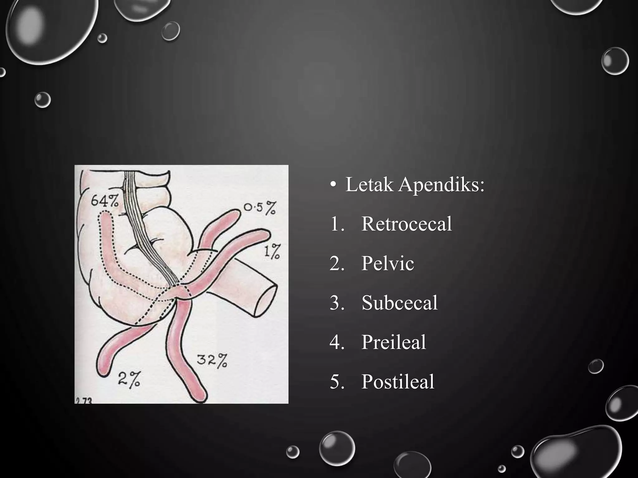 Case apendiks ppt | PPTX