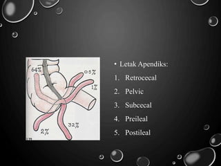 Case apendiks ppt | PPTX