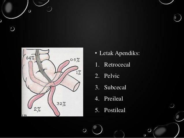 Case apendiks ppt