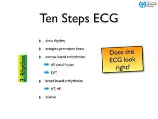 Case-Based ECG | PPT