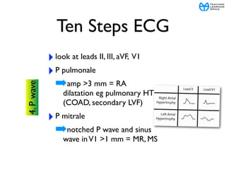 Case-Based ECG | PPT
