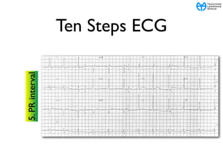 Case-Based ECG | PPT