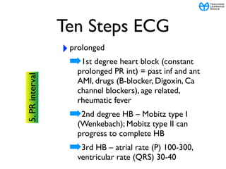 Case-Based ECG | PDF