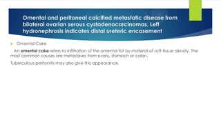 CT Abdomen Case based presentation | PPTX